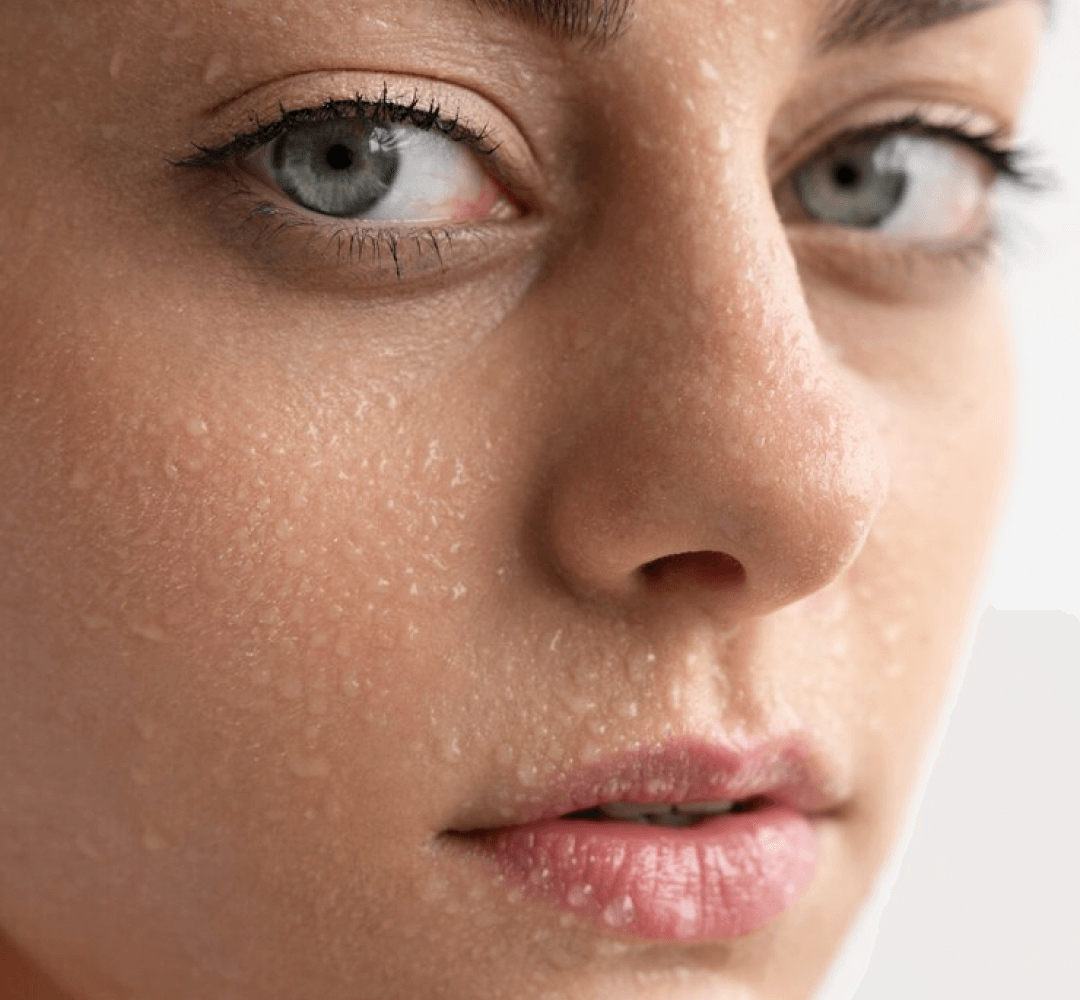 Skin Barrier Repair: Why It’s Essential and How to Support It – Vue ...