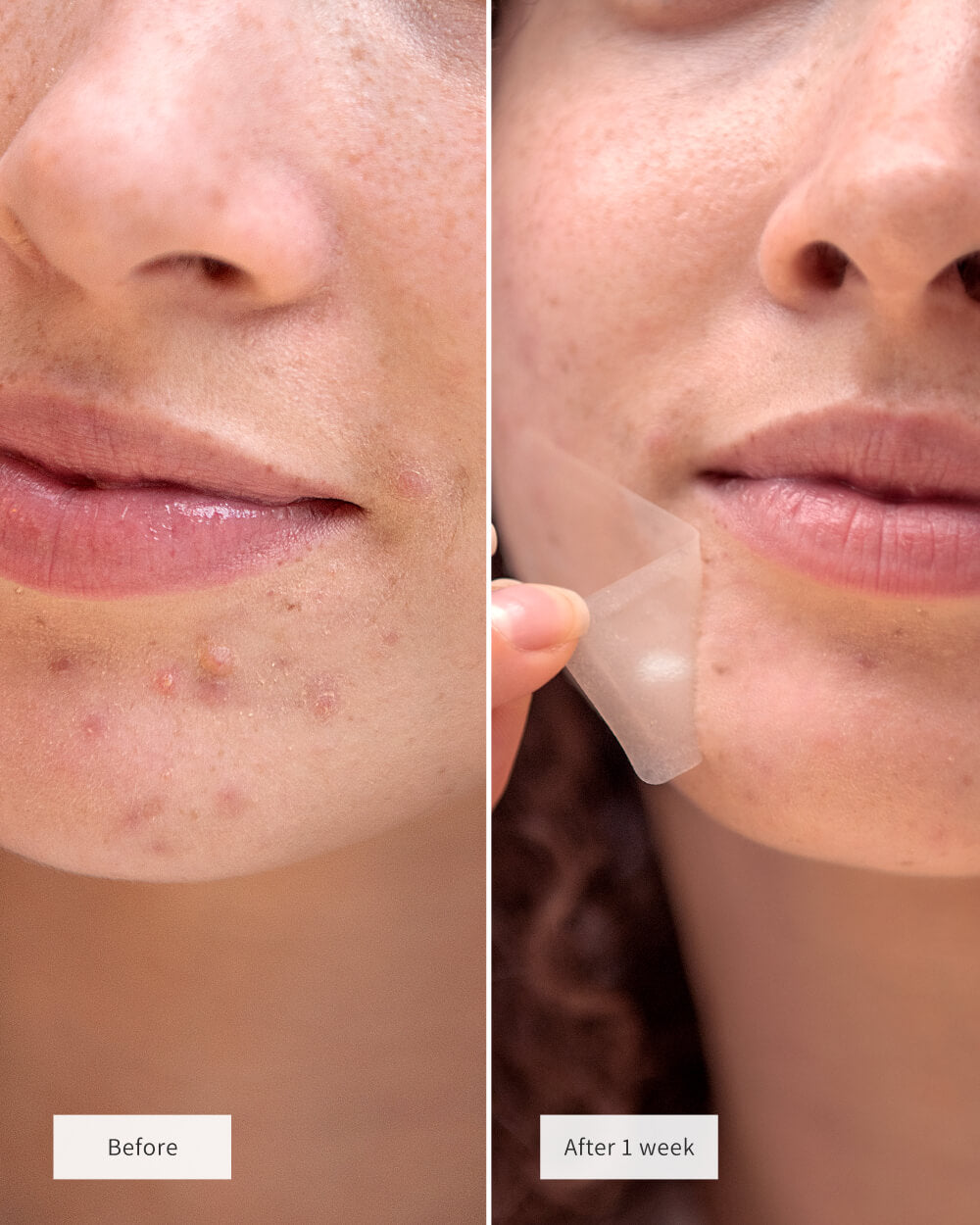 SURFACE PATCHES – Vue Swiss US